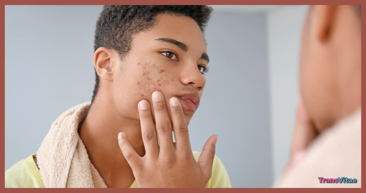 JAMA Study Details Acne Trends in Transgender Patients